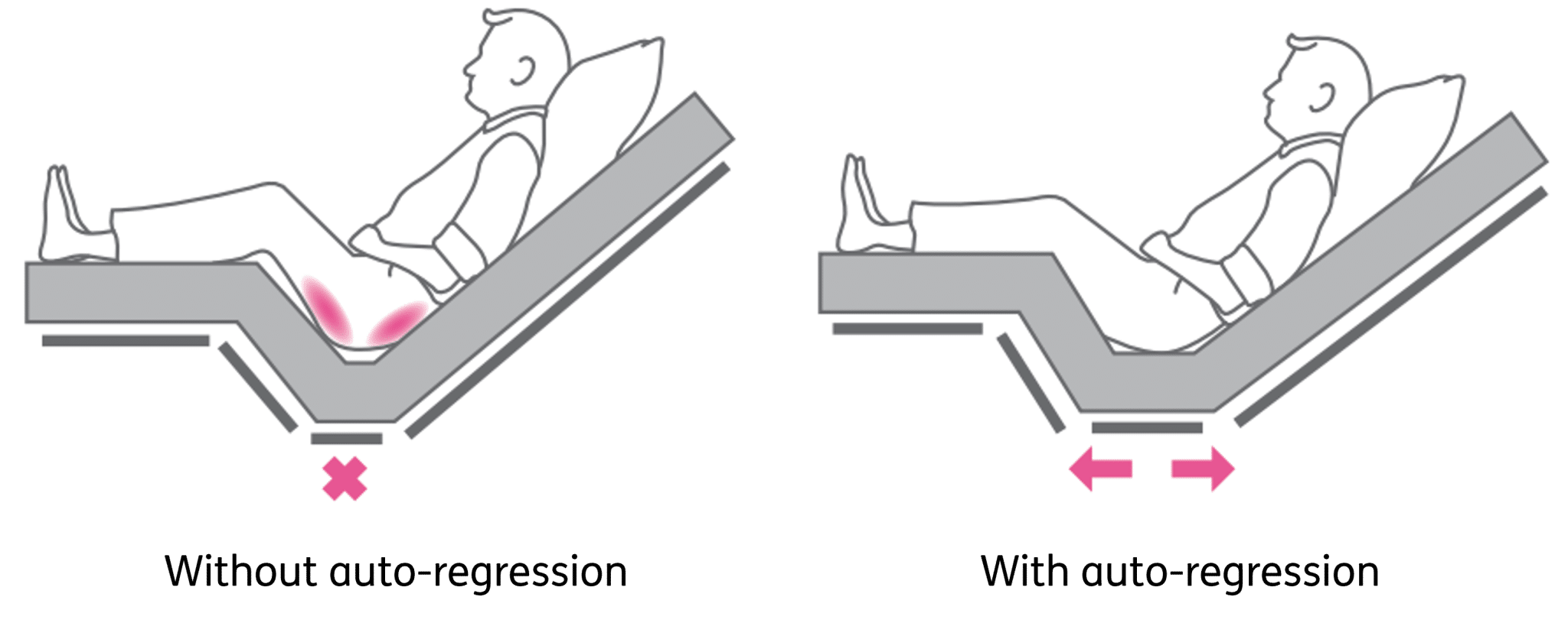 What is auto-regression on beds and stretchers? - Felgains